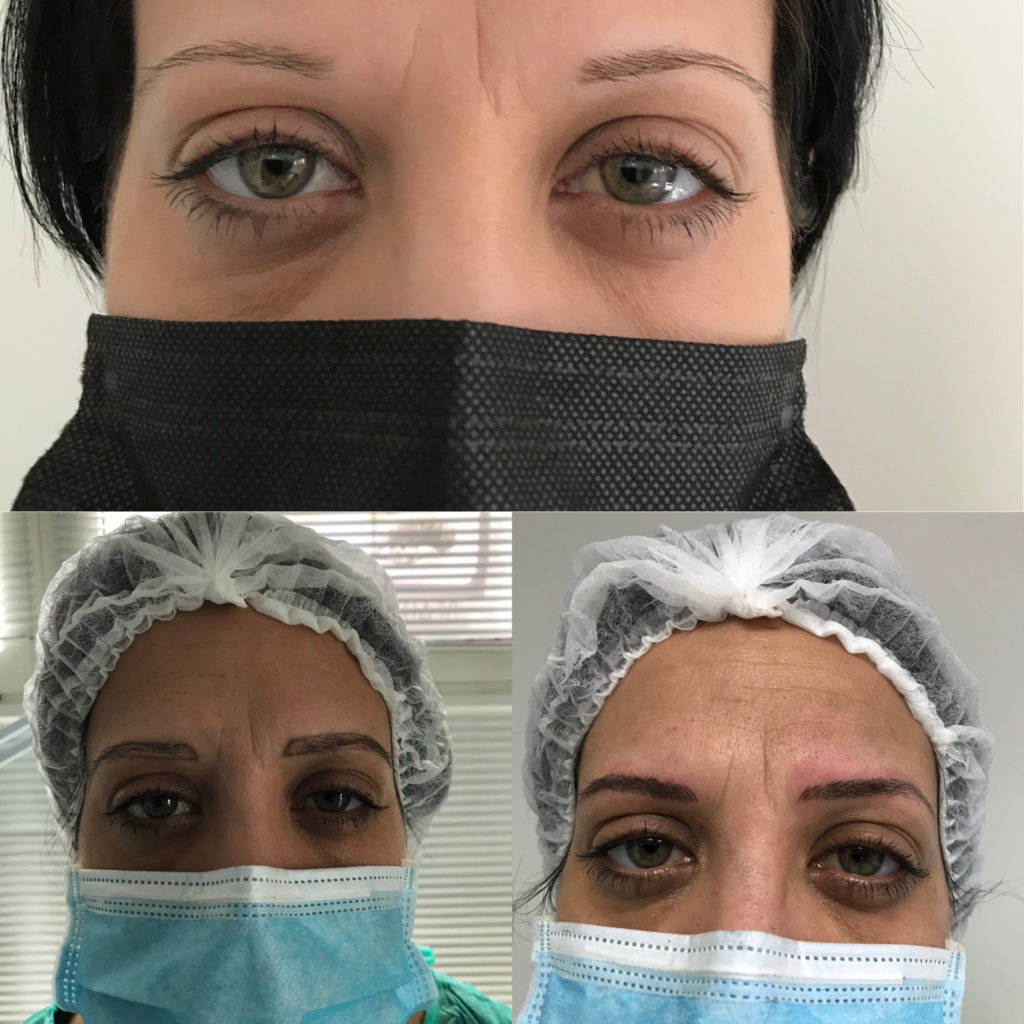 Microblading - CILS-UMINE - Cils et Sourcils Saint Gilles Croix de vie ...